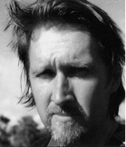 TODD SEVERSON